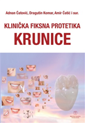 Klinicka fiksna protetika - Krunice