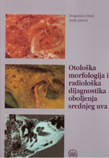 Otološka morfologija i radiološka dijagnostika oboljenja srednjeg uva