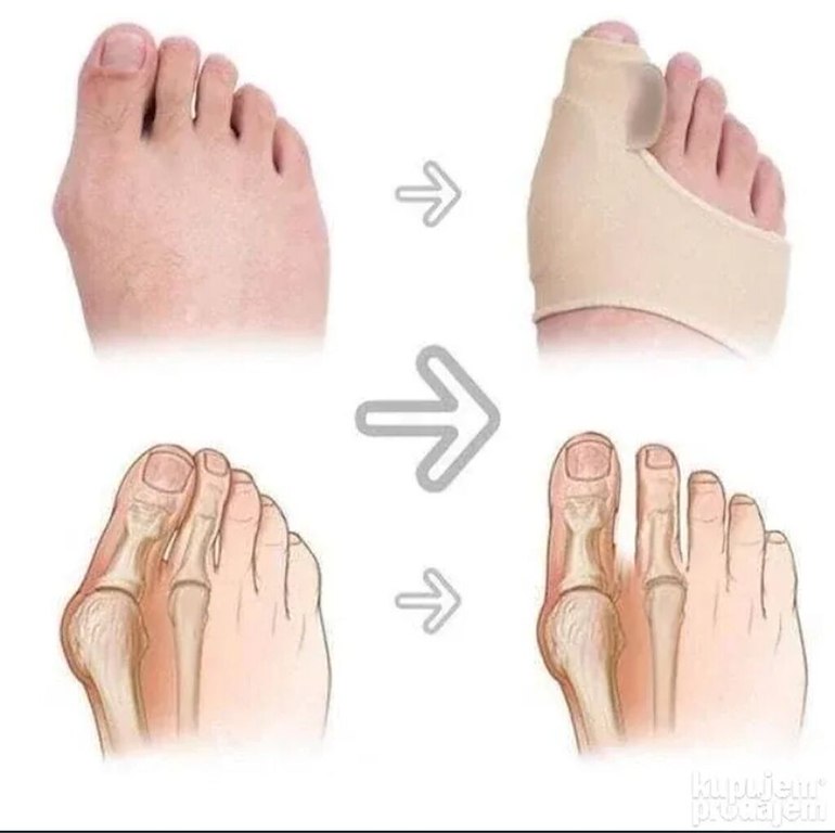 Footmate Toe Supporter – gel jastučići za prednji deo stopala sa