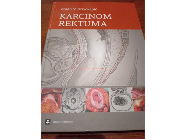 KARCINOM REKTUMA Zoran V. Krivokapić