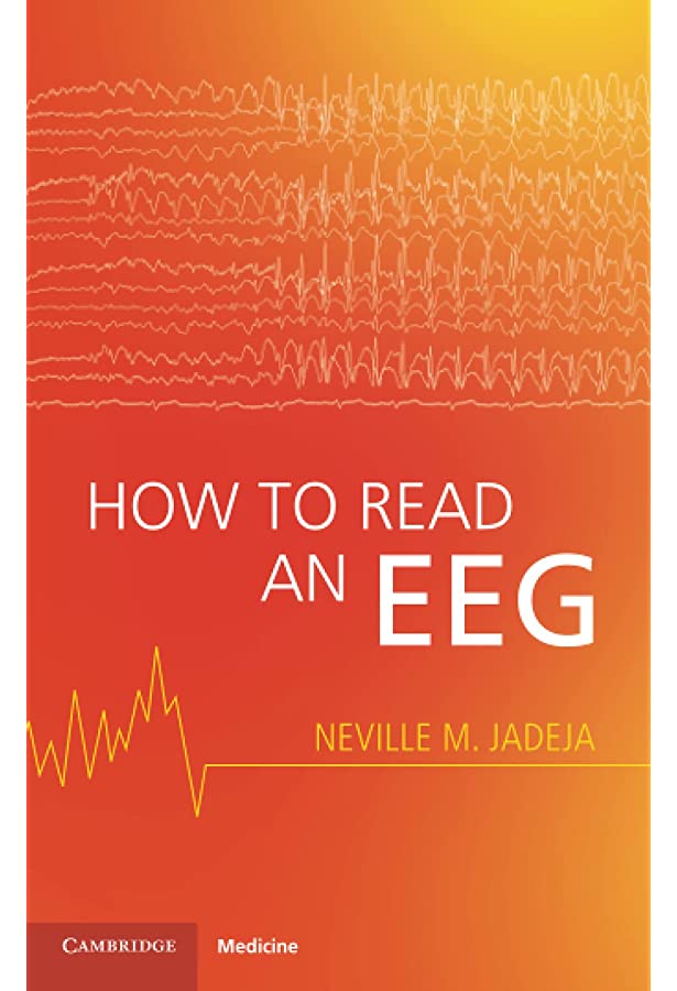 How to Read an EEG