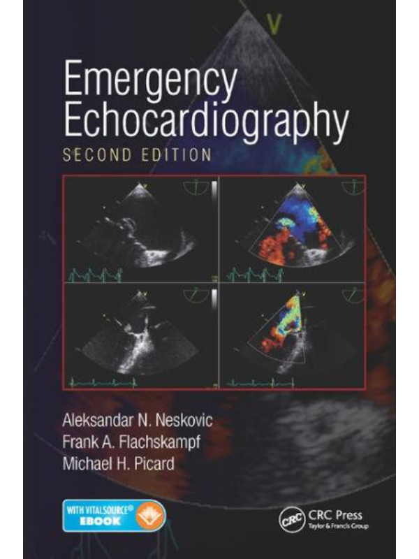 Emergency Echocardiography, 2e