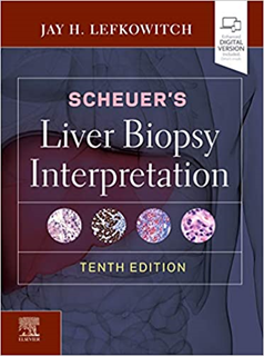 Scheuers Liver Biopsy Interpretation