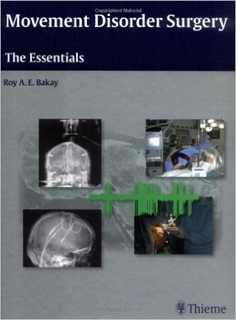 Movement Disorder Surgery: The Essentials