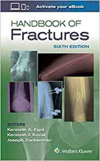 HANDBOOK OF FRACTURES 6e