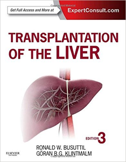 Transplantation of the Liver,