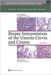 Biopsy Interp Uterine Cervix Corp 2E Cb