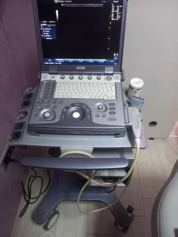 ULTRAZVUČNI APARAT