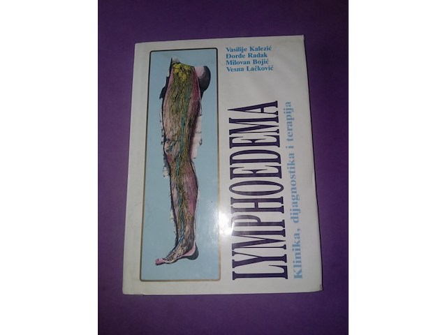Lymphoedema